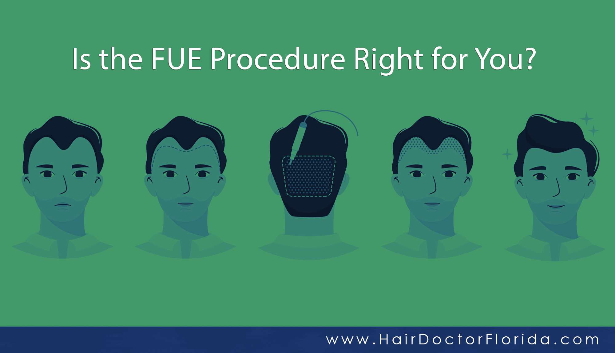 Is the FUE Procedure Right for You? - Tempus Hair